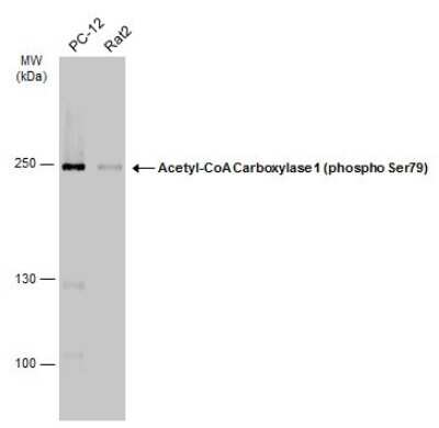 Acetyl-CoA Carboxylase alpha/ACACA [p Ser79] Antibody (NBP3-13324 ...